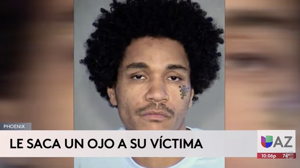 Homeless Man Rips Out Victim's Eyeball In Unprovoked Attack