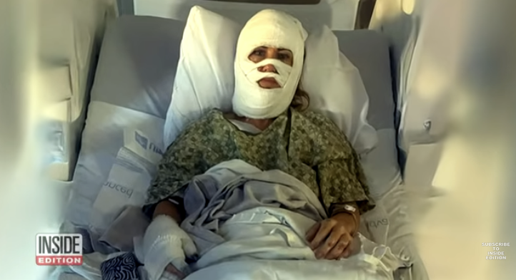 FBI Offers Reward For Info About Georgia Acid Attack Suspect